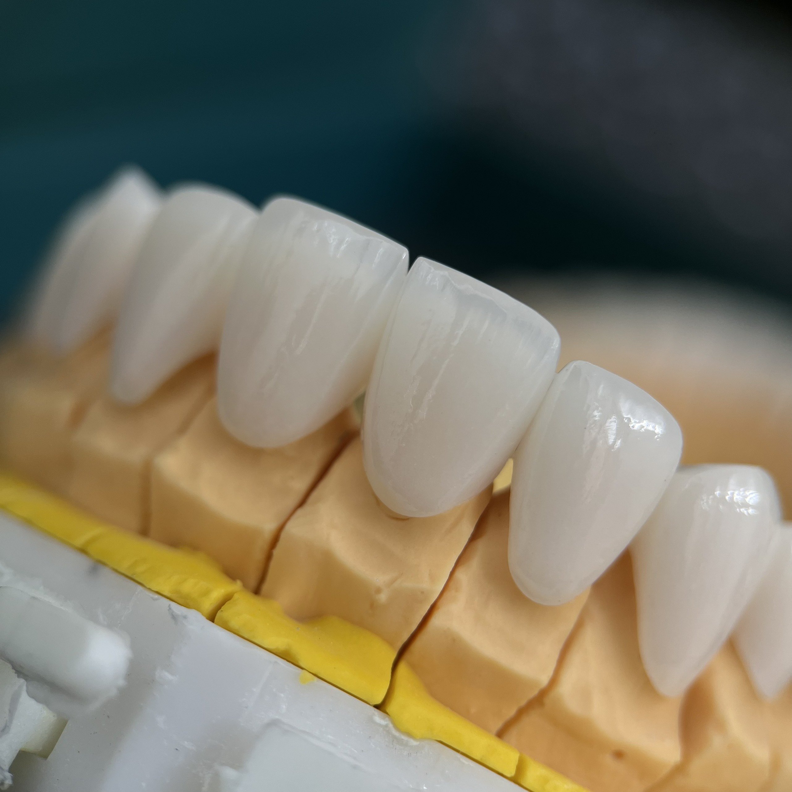 Bảng Giá Làm Răng Tại Nha Khoa Smile | Dịch Vụ Uy Tín Đồng Bằng Sông Cửu Long